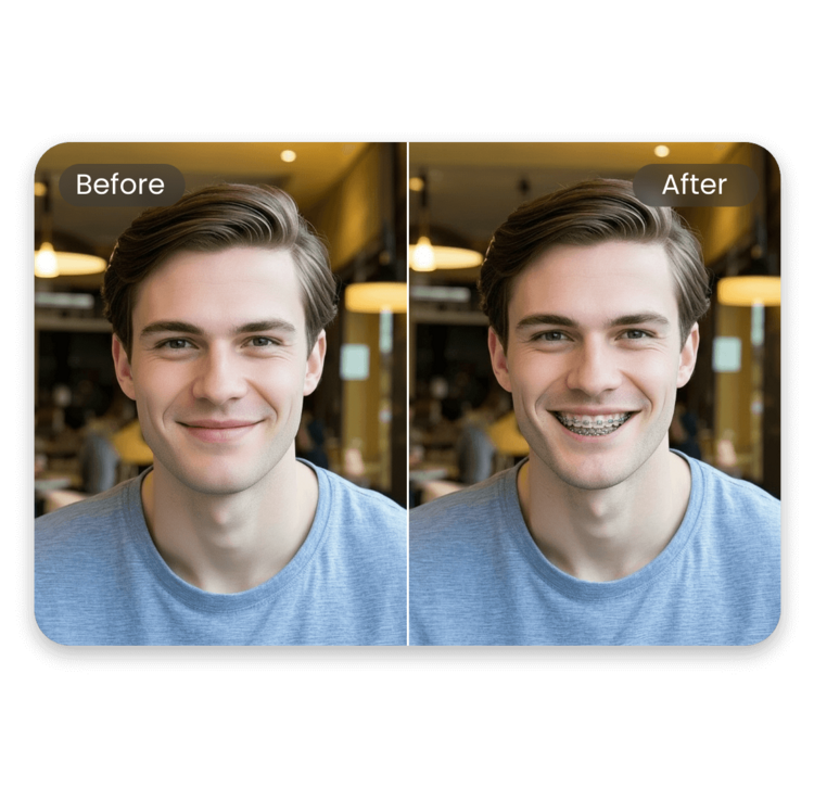 Free Braces Filter Online – AI Braces Simulator Try‑On Tool | Clipfly